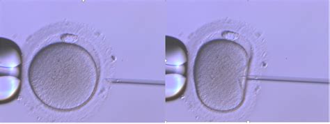 Egg And Sperm Fertilisation With Ivf Immature And Mature Eggs