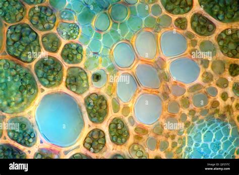 Polarized Light Micrograph Of A Transverse Cross Section Through The