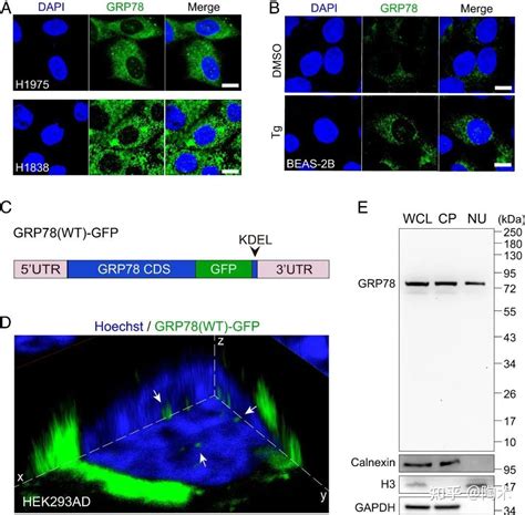 Pnas 重磅 一种新型癌细胞转移机制 知乎