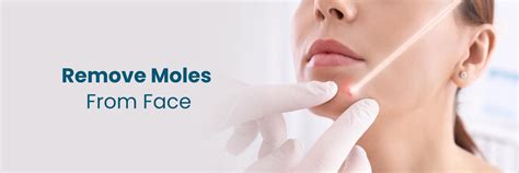 ሞሎችን ከፊትዎ ላይ እንዴት ማስወገድ እንደሚቻል ጠባሳ ነጻ ዘዴዎች