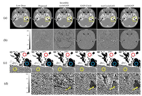 Results From The Temporal CT Dataset A CT Images For The Comparison Download Scientific