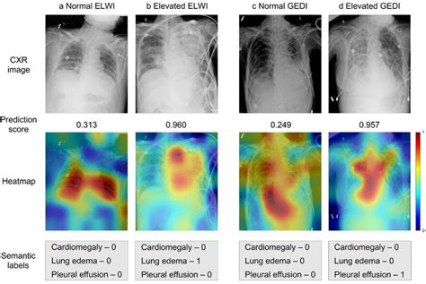 Heat Map Of The Dl Model As Well As Its Corresponding Prediction Score