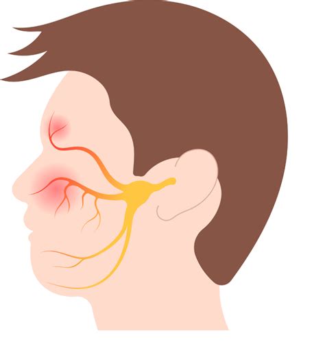 Trigeminal Dysphoria A Newly Discovered Cause Of Headaches For Millions The Headache Relief Diet
