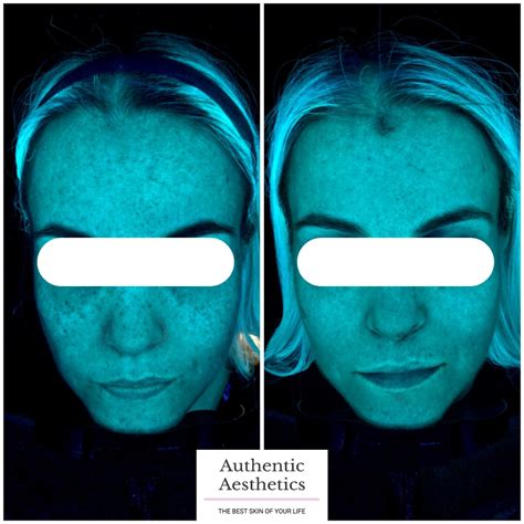 Cosmelan Authentic Aesthetics