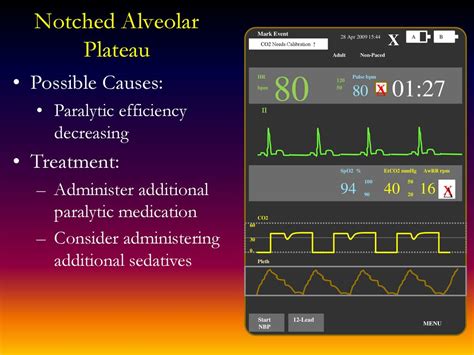 Pre Hospital Capnography Ppt Download