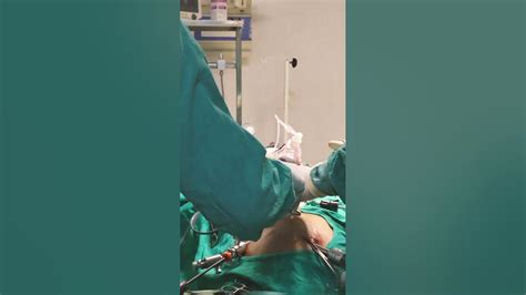 Laproscopy Surgery Youtube
