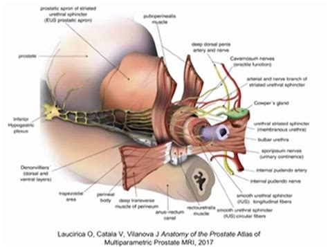 Suo 2021 Local Regional Anesthesia Considerations For Transperineal And Transrectal Prostate Biopsy