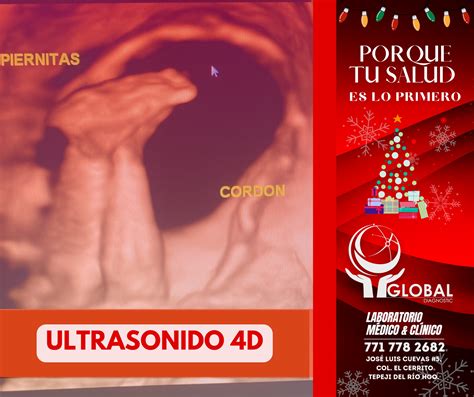 El Desarrollo De Tu Bebé Es Global Diagnostic