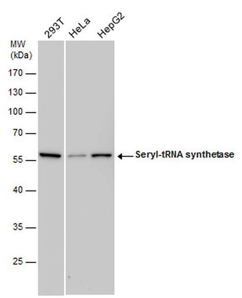 Seryl Trna Synthetase Polyclonal Antibody Pa5 29761