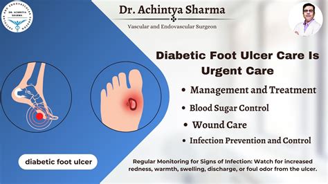 Diabetic Foot Ulcer Signs Care And Prevention