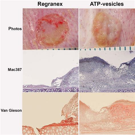 Histology And Immunohistochemistry Examinations Of Wounds Treated With