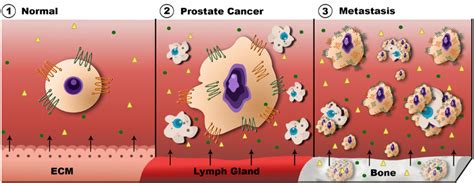 Chemokines And Their Receptors In The Promotion Of Prostate Cancer