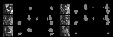 the output of the four segmentation models at different positions form