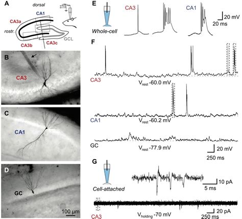 Pyramidal Neurons Hippocampus