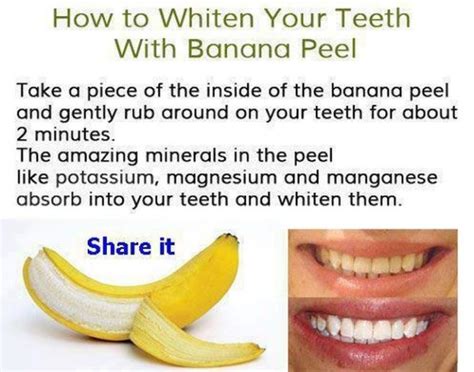 Health Benefits Of Bananas My Daily Magazine Art Design Diy