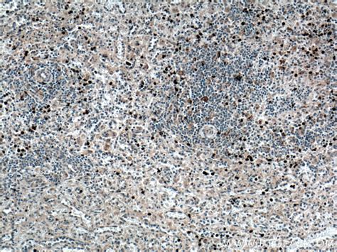 Mmp 9 Middle Antibody 27306 1 Ap Proteintech