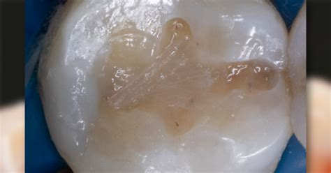 Interlig® Angelus Odontologia