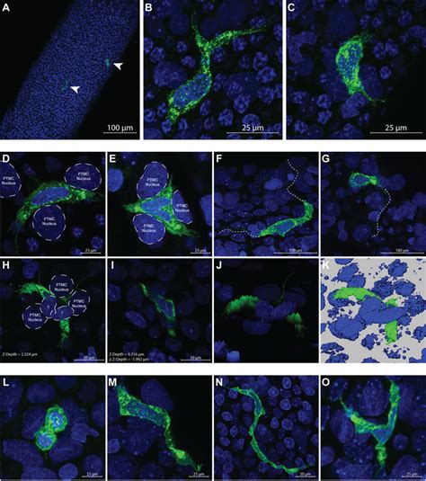 A Major Histocompatibility Complex Class Ii Mhcii þ Peritubular