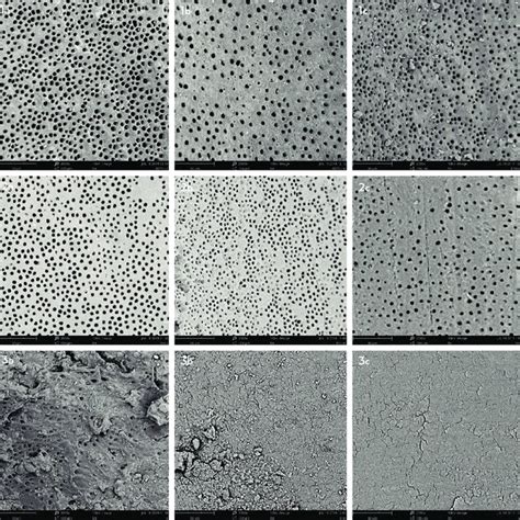 Sem Microphotographs Of Root Canal Walls Instrumented With 17 Edta