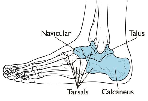 Tarsal Coalition OrthoInfo AAOS