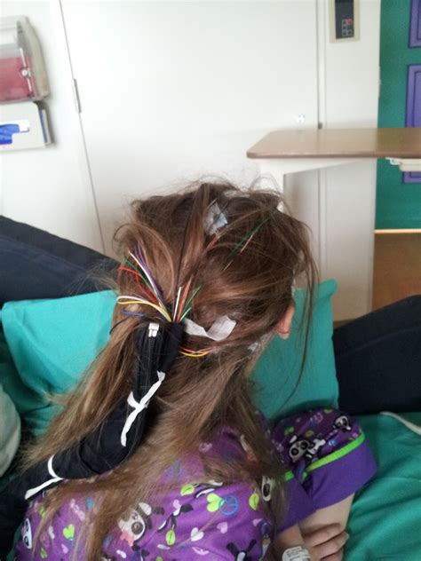 Our Journey Through Epilepsy Eeg Monitoring