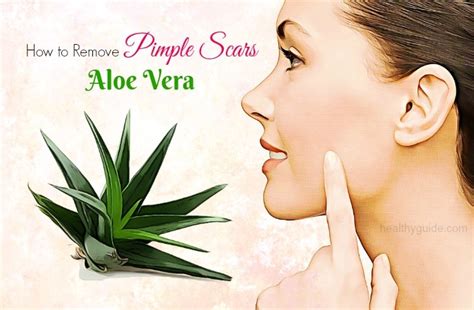 Tips How To Remove Pimple Scars On Nose Chest Back Legs Fast