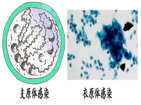 支原体衣原体感染药物治疗要多久才能好 快速问医生 免费咨询 补肾参考网