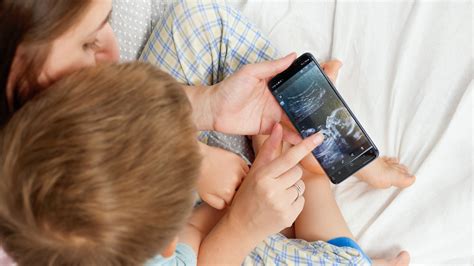 Ultra Compact Ultrasound And The Rise Of Pocus Acertara