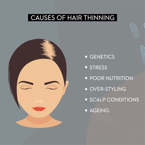 Causes And Solutions For Hair Thinning Ask The Nurse Expert