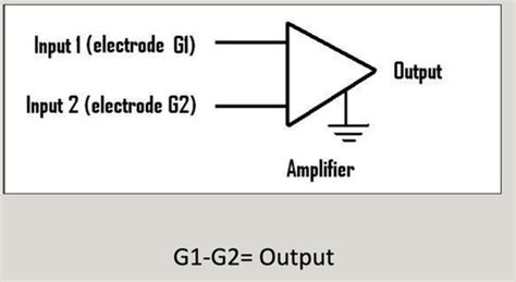 EEG IA Basic EEG Technology Flashcards Quizlet