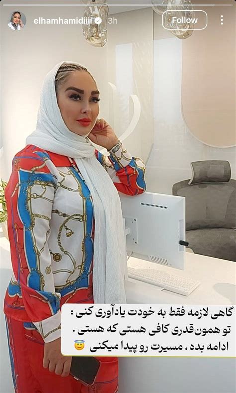 تغییر چهره الهام حمیدی بازیگر سریال آتش و شبنم در ۴۸ سالگی