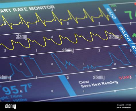 Cardiac Frequency Diagram Stock Photo Alamy
