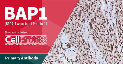 Cellpath A Statlab Company On Linkedin Immunohistochemistry Ihc