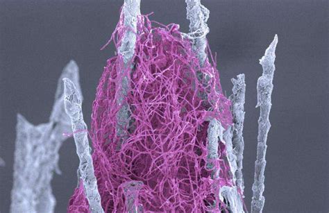 Scientists Identify Tissue Degrading Enzyme In White Nose Syndrome