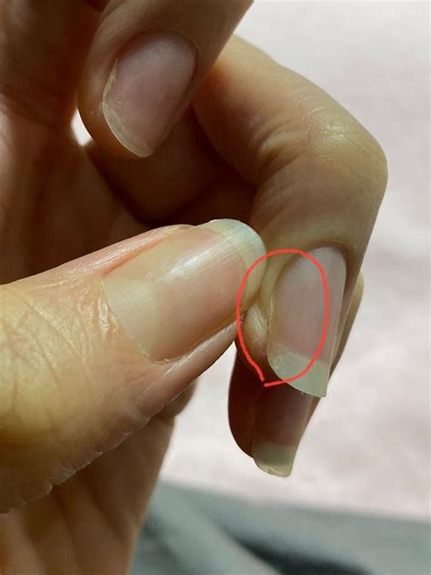 問題 甘皮修剪問題 美甲板 Dcard