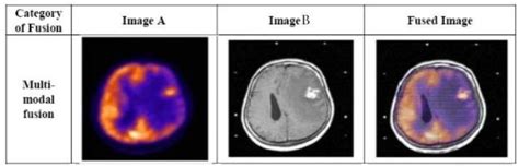 Multi View Fusion 12 Multi Modal Fusionthe Various Modalities For Download Scientific