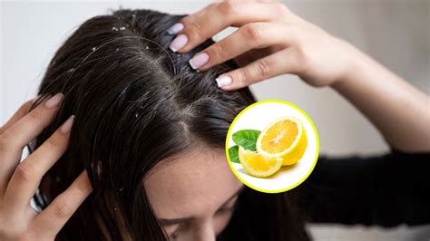 Dandruff Problem डैंड्रफ को कम करने के लिए न करें नींबू का इस्तेमाल