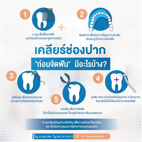 ทำไมต้องเคลียร์ช่องปาก ก่อนจัดฟัน มีอะไรบ้าง 🦷 1 X Ray เพื่อเช็ค