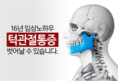 청구경희한의원 턱관절클리닉
