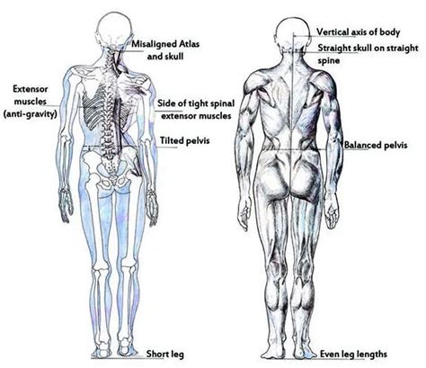 Why The Spine Goes Out Of Alignment Functional Wellness Clinic