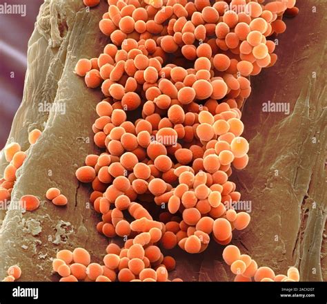 Lactococcus Lactis Bacteriacoloured Scanning Electron Micrograph Sem This Lactic Acid