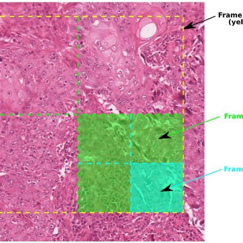 Wsi Exploration Model For Digital Pathology 2 Download Scientific