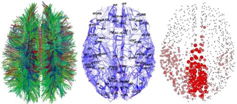 Brain Connections – Resting State fMRI Functional Connectivity | Diffusion Tensor Tractography ...