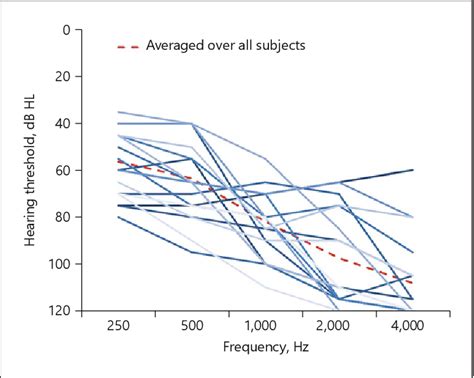 Figure 1 From The Effect Of Binaural Beamforming Technology On Speech Intelligibility In Bimodal