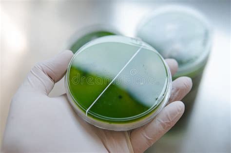 Mycelium Selection Cultivation And Reservation Of Mushrooms Under