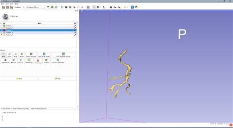 3d Slicer简易版中文教程🙃 掘金