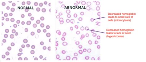 Non Regenerative Anaemia Flashcards Quizlet