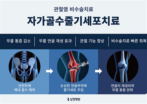 퇴행성관절염 자가골수 줄기세포 치료를 통해 해결하세요