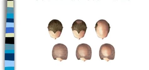 Types Of Reproduction In Plants Typical Flowers Structure And Sex Of Flower Science Online