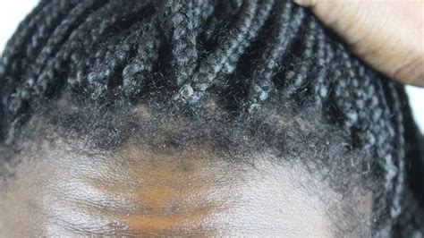 Scalp Health Enhancement Tips For Optimal Scalp Care